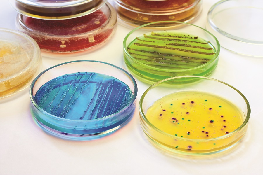 Waterborne Pathogens | Environmental Safety Technologies Inc